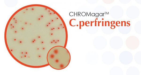 CHROMagar™ Candida Plus & C.perfringens | AnalytiChem